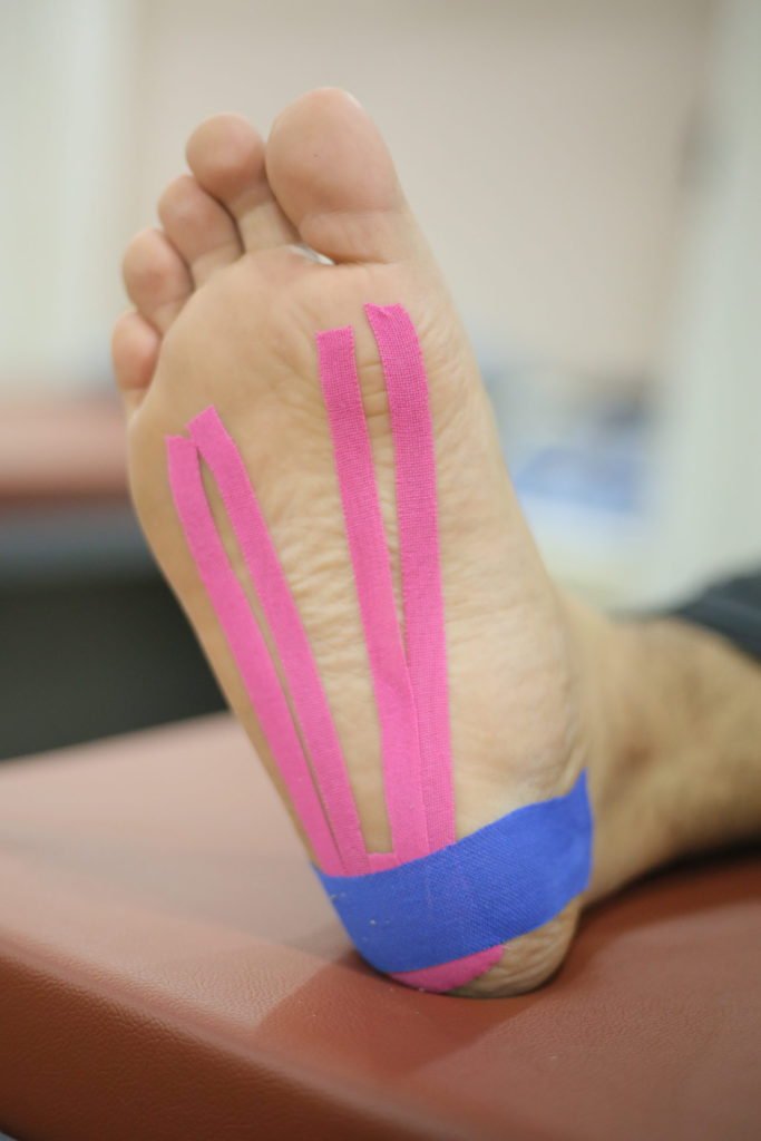 Tapping – Solace Physiotherapy Centre